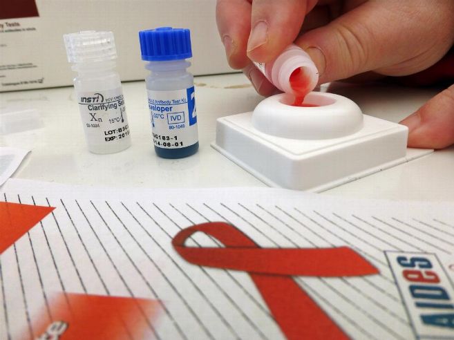 Le Test Rapide d'Orientation Diagnostique (TROD) | Le planning familial