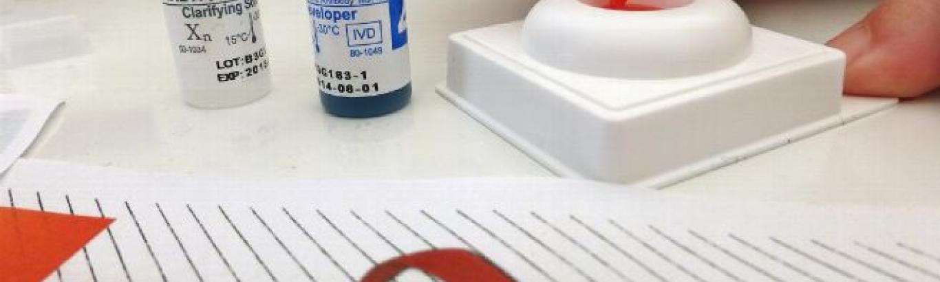 Le Test Rapide d'Orientation Diagnostique (TROD) | Le planning familial